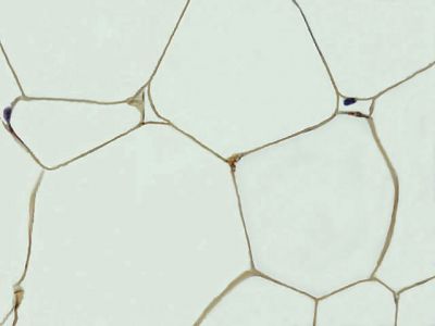 Fat Cells and Cancer Risk | National Institutes of Health (NIH)