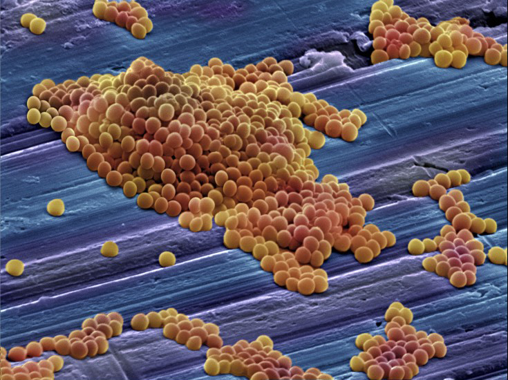 Studies Suggest How Drug-Resistant Staph Evolved | National Institutes ...