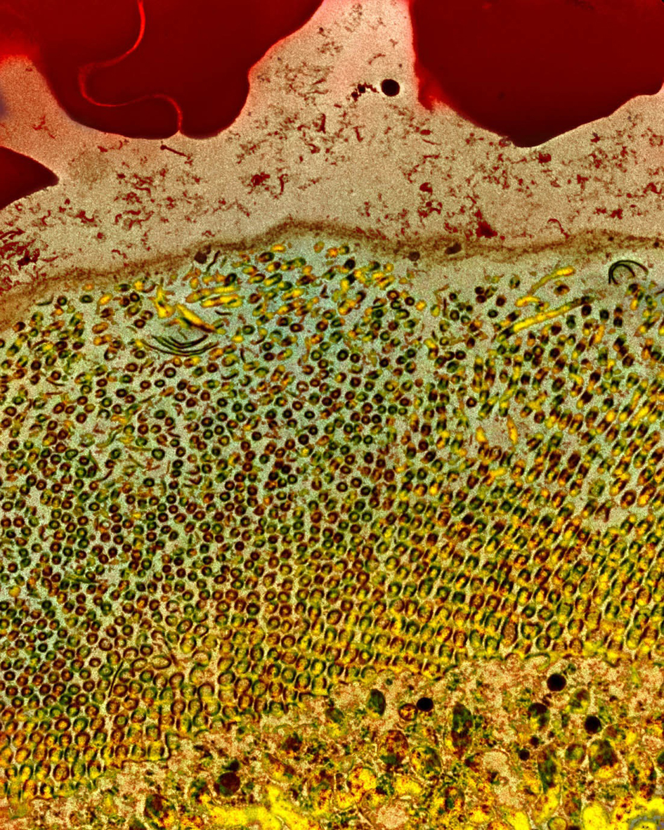 Mosquito Defense Mechanism Protects Malaria Parasite | National ...
