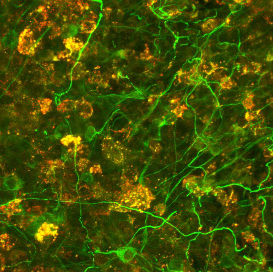 Insight into Memory Loss in Alzheimer’s Disease | National Institutes ...