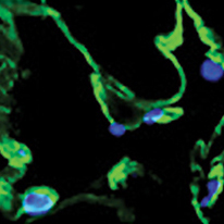 The Mechanism of Muscle Loss in Cancer | National Institutes of Health ...