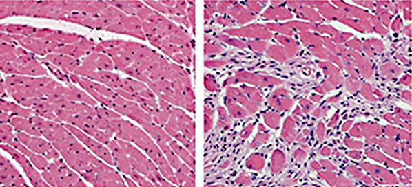 Immune Cells in Heart Help it Mend | National Institutes of Health (NIH)