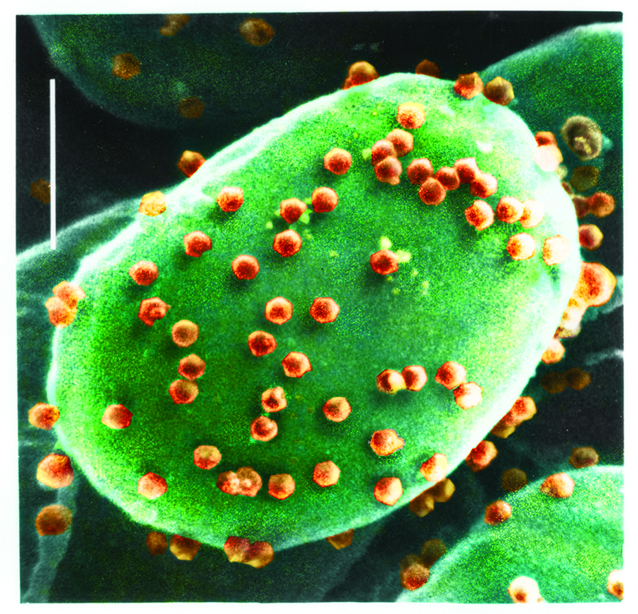 Algal Virus Infects, Affects Humans | National Institutes of Health (NIH)