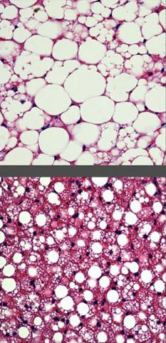 Insights into Energy-Burning Fat Cells | National Institutes of Health ...