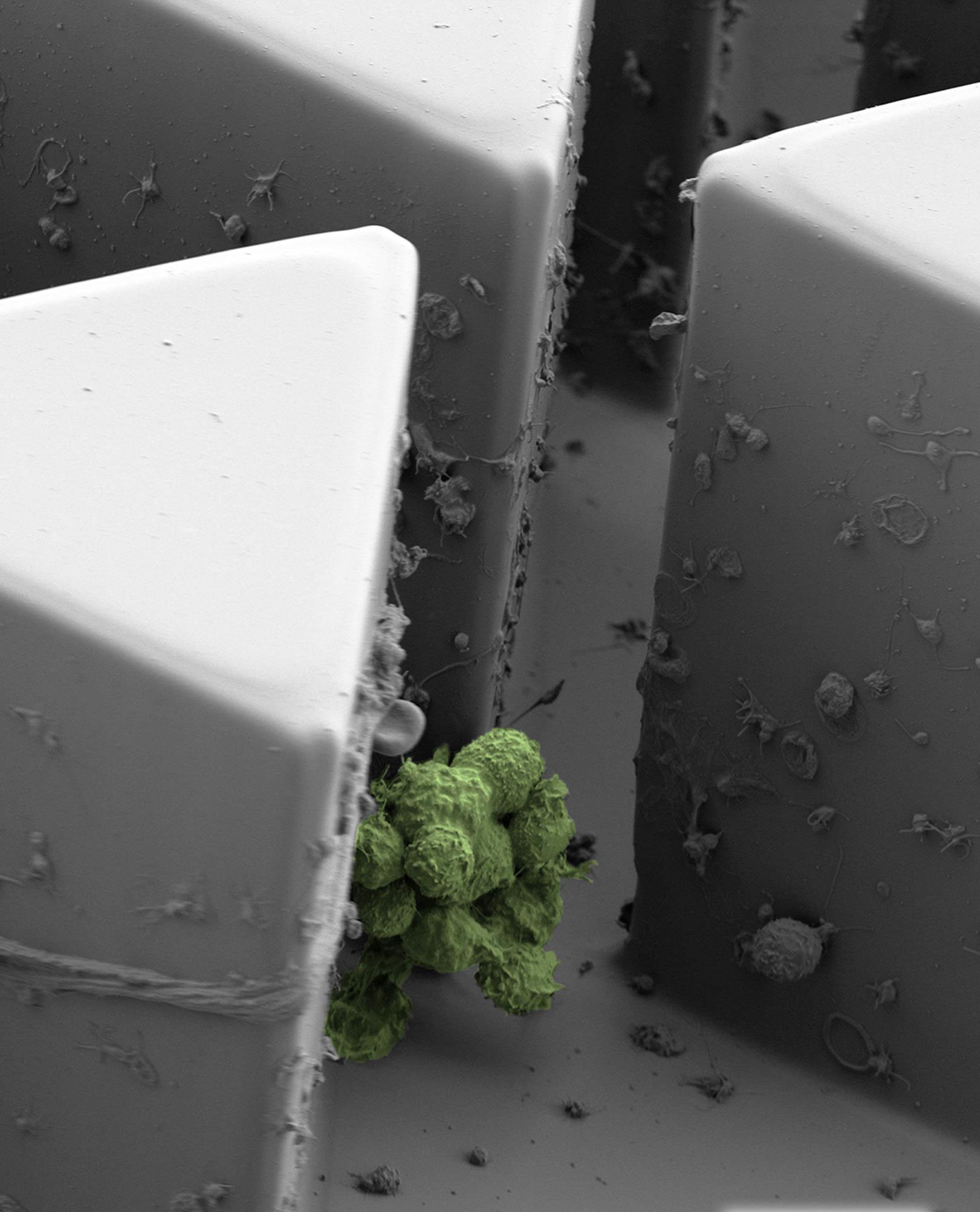 Microchip Captures Clusters of Circulating Tumor Cells | National ...