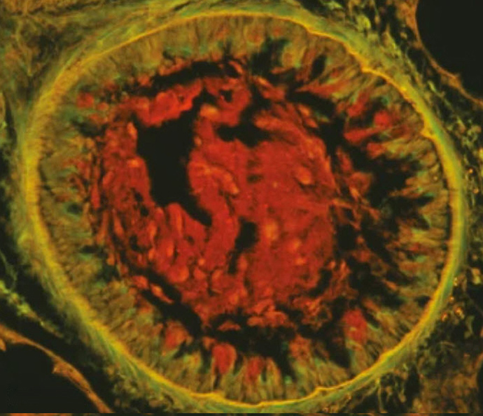 Compound blocks excess mucus secretion in mouse lungs | National ...