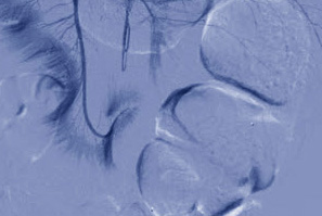 Restoring cell and organ function after the heart stops | National ...