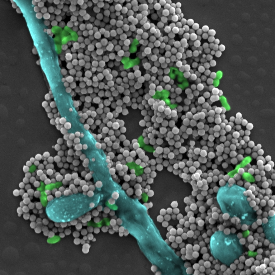 Swarm of tiny robots scrub teeth | National Institutes of Health (NIH)