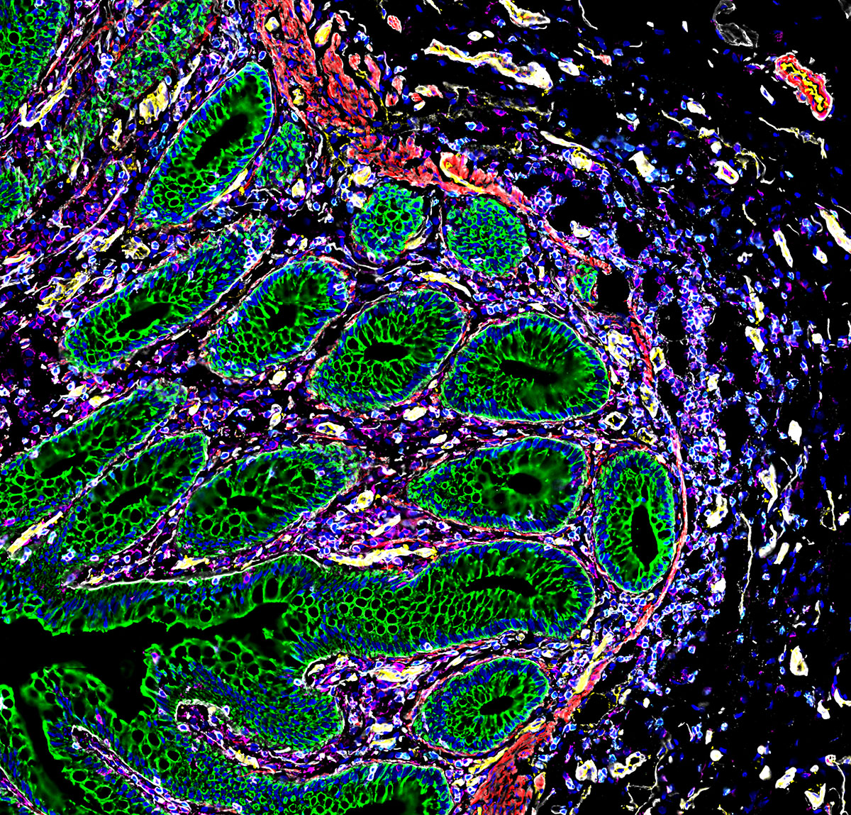 Cell atlases give detailed views of human organs | National Institutes ...