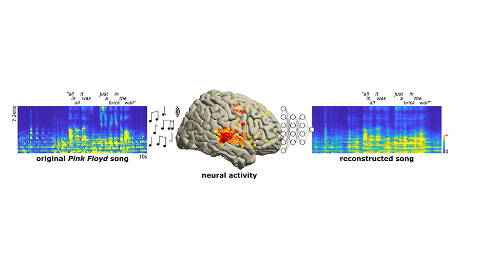 Scientists translate brain activity into music | National Institutes of ...